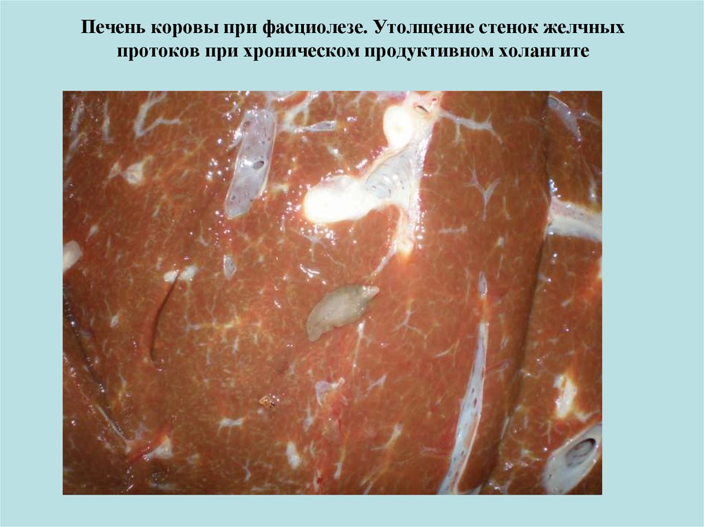 Что такое фасциолез - симптомы, диагностика и лечение - Паразиты и ...